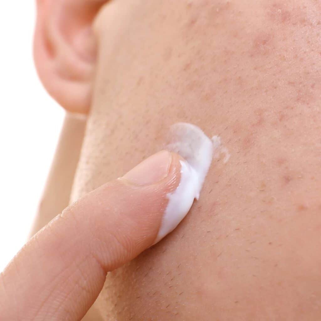 Boutons Sur Le Visage : Guide Expert pour Les Prévenir et Traiter